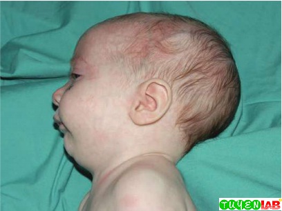 [Pediatric] Atlas of congenital anomalies of the head and neck | Free ...