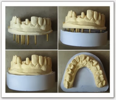 la réalisation 1 dowel pins positionnés dans l empreinte et maintenus ...