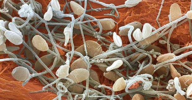 Medical and Health Science: Human sperm-Under microscope!!!