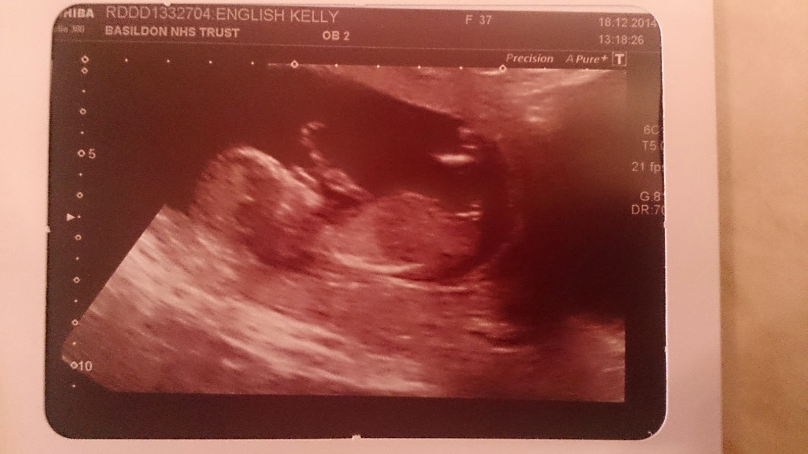 'Aving A Baby! | 0ddness Bl0g