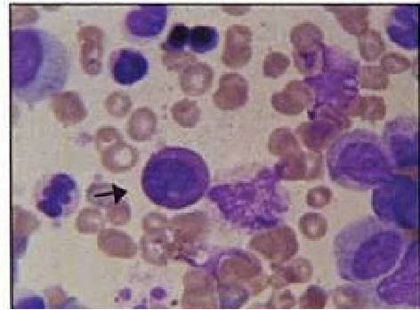 fichero hematologia: Metamielocito