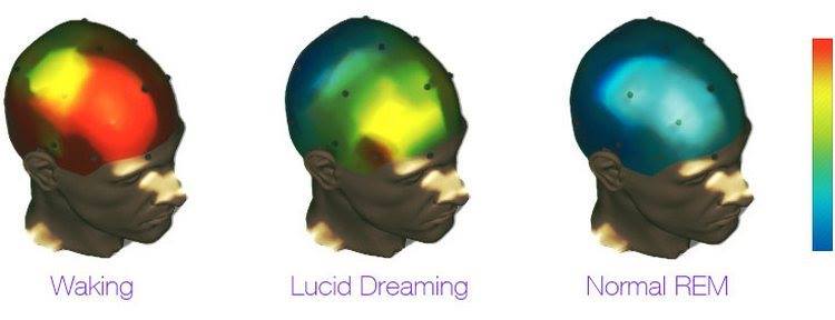 amudu: Your Brain When Lucid