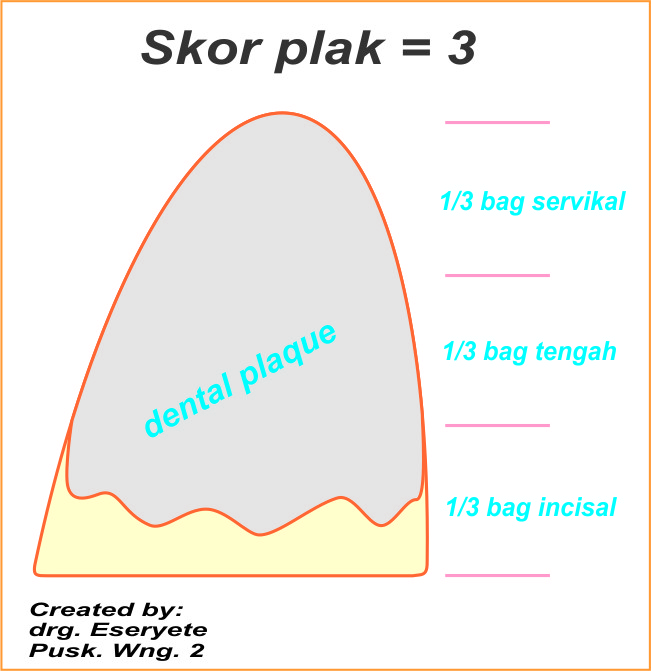 PDGI CABANG WONOGIRI: TATA CARA PENILAIAN STATUS KESEHATAN GIGI DAN ...