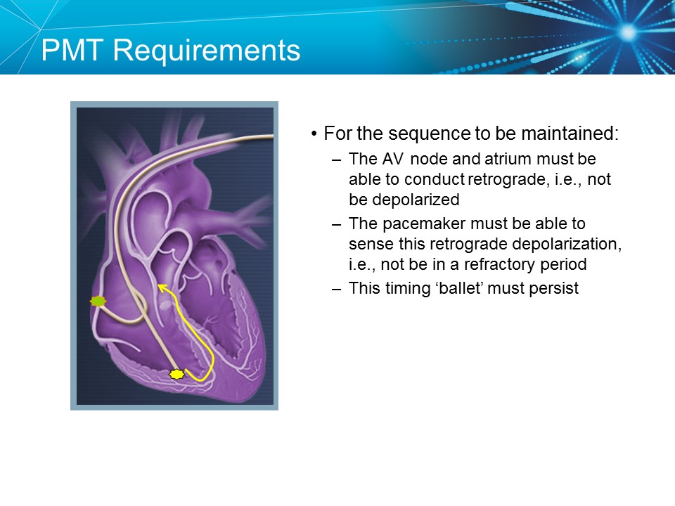 CVT Mohd Farid: Basic Pacemaker Troubleshooting Part II-Medtronic Academy