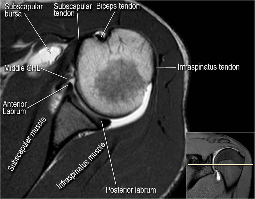 MRI Musculo-Skeletal Section: Axial view check list.