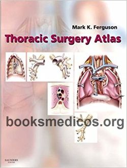 Thoracic Surgery Atlas Mark K. Ferguson | booksmedicos