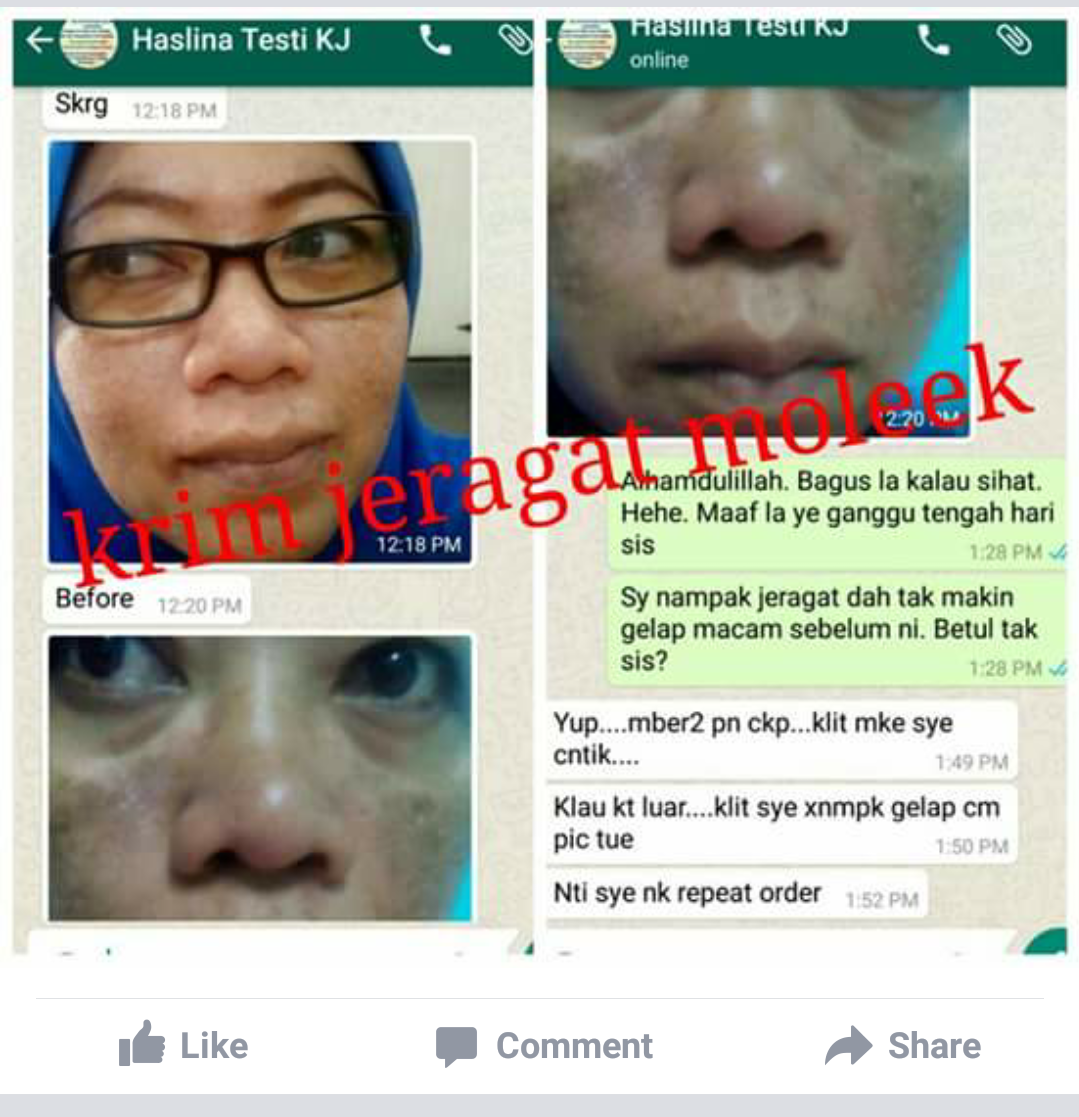 MAHFUZAH_ ESHOP BORONG RETAILS MURAH 013-3045279: KRIM JERAGAT MOLEEK ...