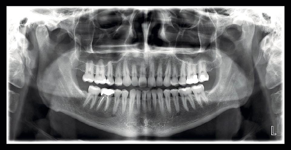 LAUREOLUS BLOG.: La llengua dels dentistes.