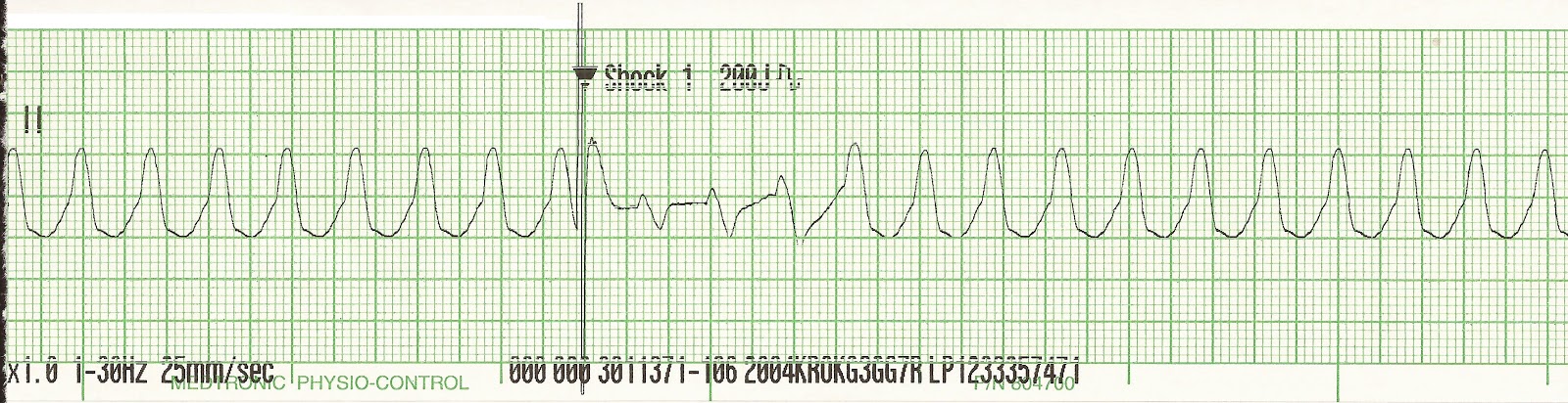 Electrical Interventions