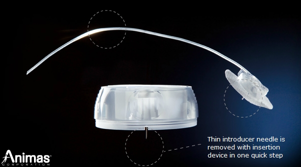 Gar's World: Required Insulin Pump Infusion Set Review