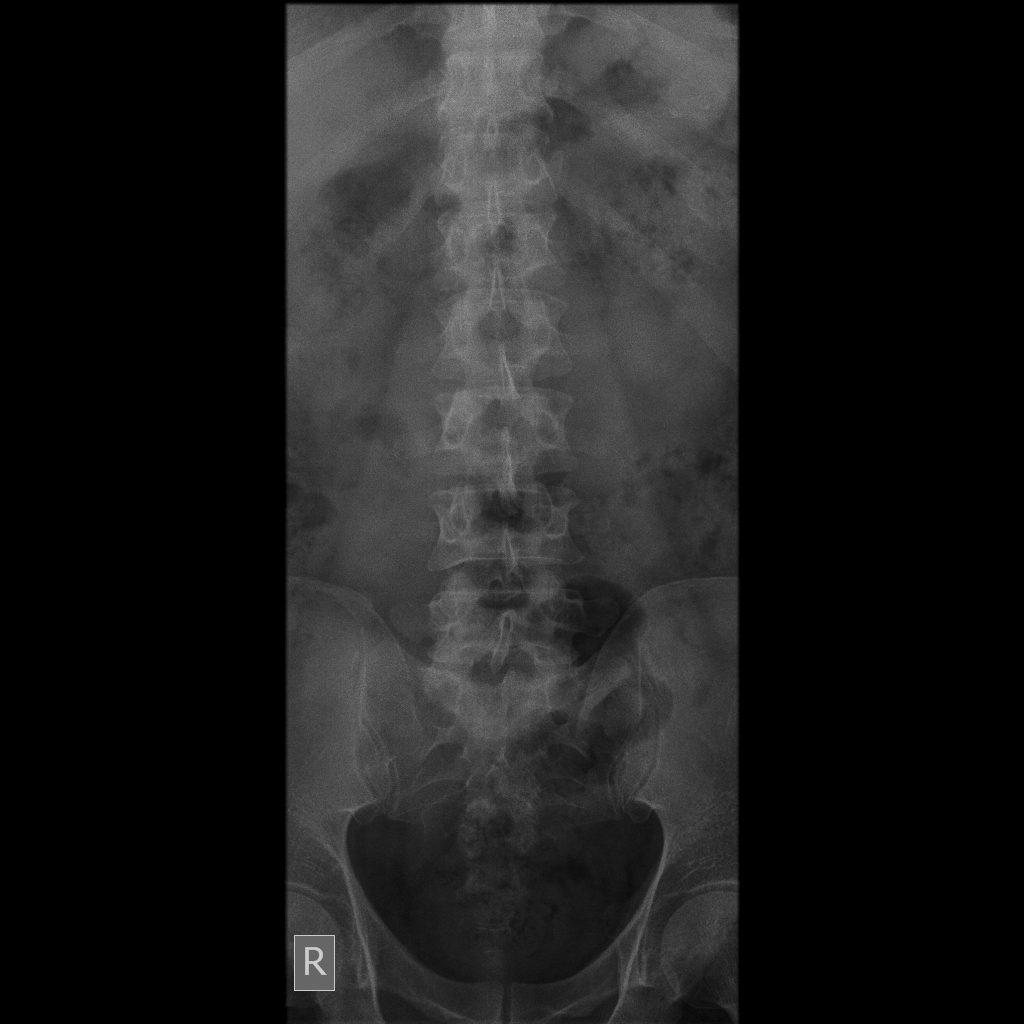 Radiography - The less favoured learning Topic, Yet essential - Sumer's ...