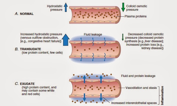 Ce que tu cherche : Vascular Changes of ACUTE INFLAMMATION