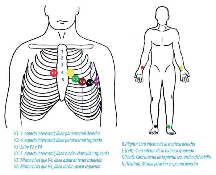 TOMA DEL ECG: TÉCNICA CORRECTA Y ERRORES MÁS FRECUENTES.