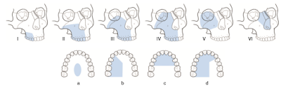 Oral and Maxillofacial Surgery
