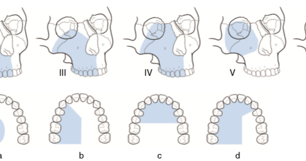 Oral and Maxillofacial Surgery