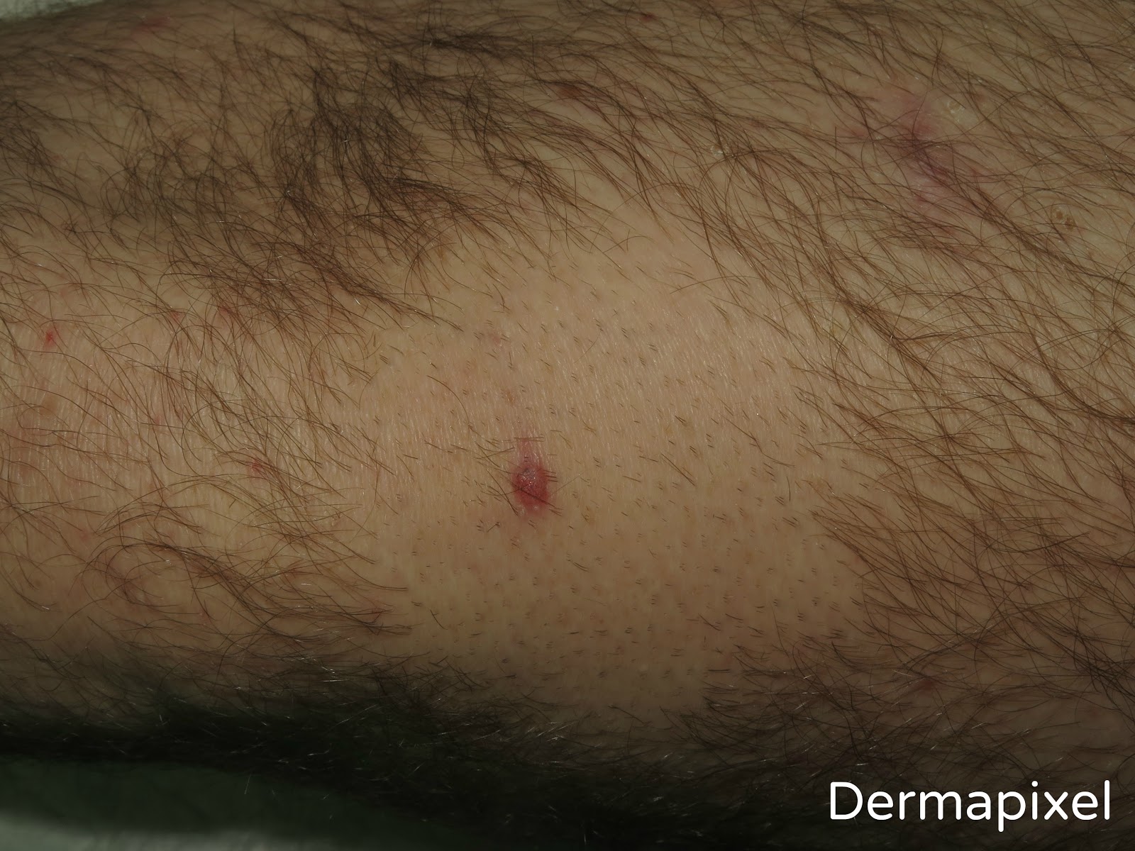 Dermapixel: agosto 2017