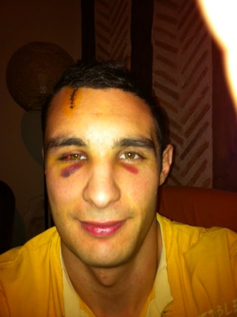 Grégory Capra: Matthieu : dur, dur, le rugby