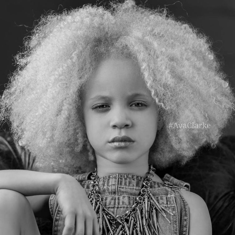 Ava Clark - A Young Girl is an albino, come to be an african american ...