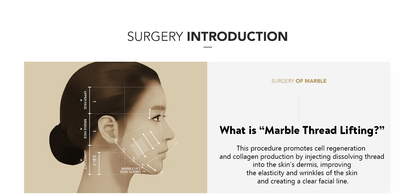 Basic Facts and Types about Thread Lifting