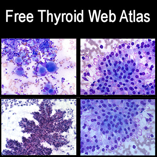 Medical Laboratory and Biomedical Science: Free Online Atlas of Thyroid ...
