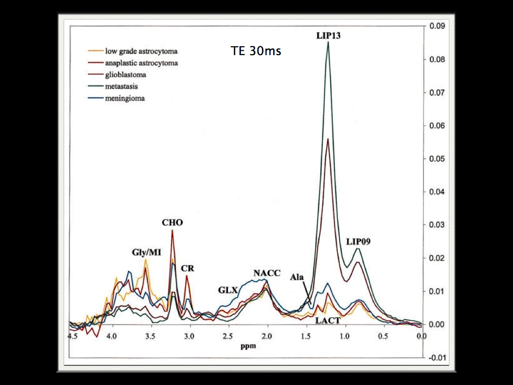 MRI BLOG: Proton MRS Spectra for Selected Brain Pathologies