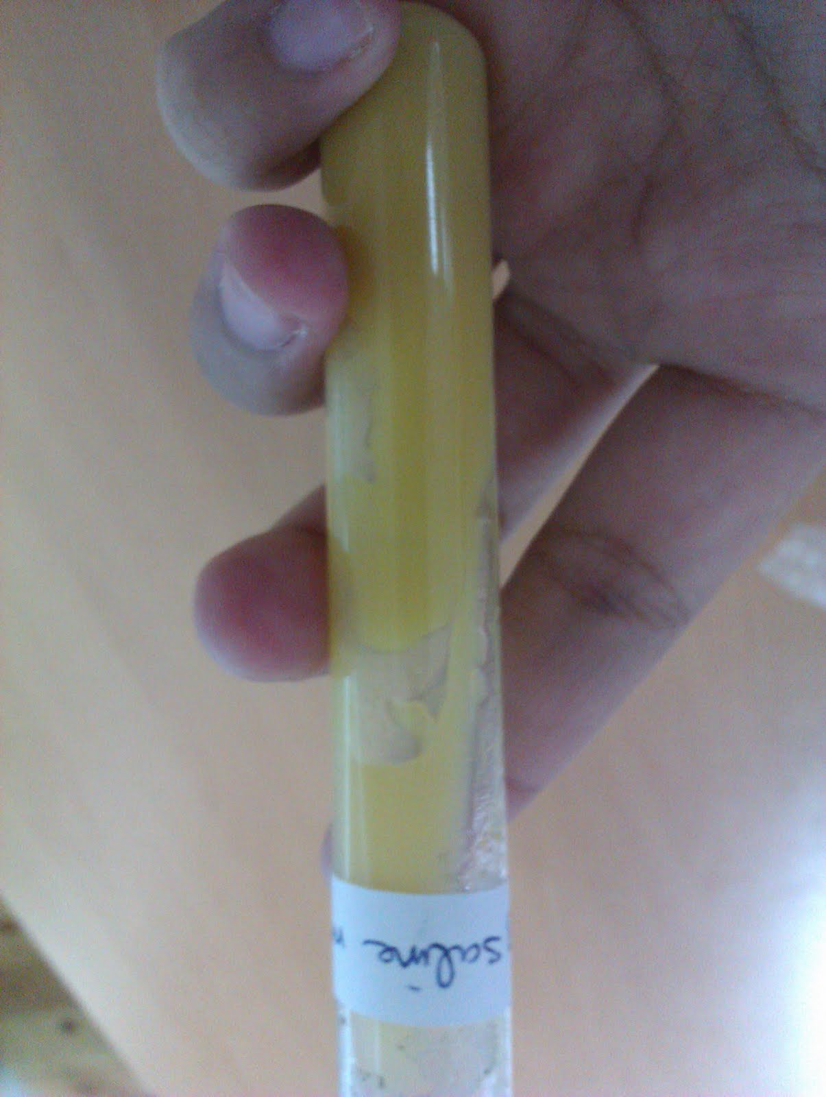 tamaniyah tibb team :): microb RS