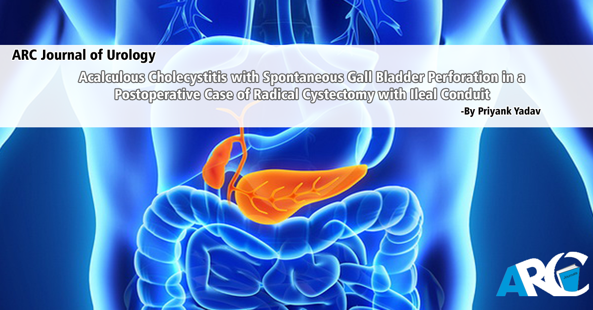 Acalculous Cholecystitis with Spontaneous Gall Bladder Perforation in a ...