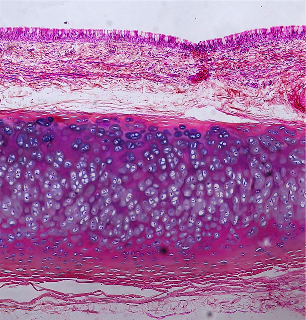 SOS BIOLOGIA CELULAR Y TISULAR: RESPIRATORIO