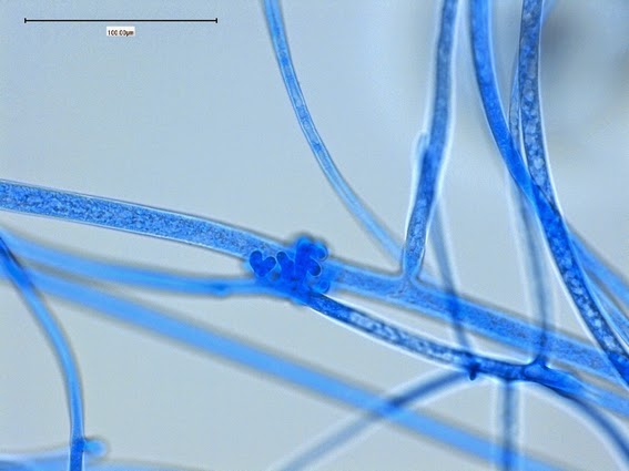 Fun With Microbiology (What's Buggin' You?): Apophysomyces elegans ...
