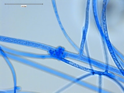 Fun With Microbiology (What's Buggin' You?): Apophysomyces elegans ...