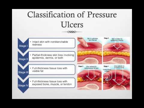 PRESSURE SORES - DNB Orthopaedics MS Orthopedics MRCS Exam GUIDE ...