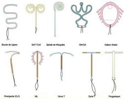 Le disposition intra utérine « Le DIU » ~ Santé et les soins infirmiers