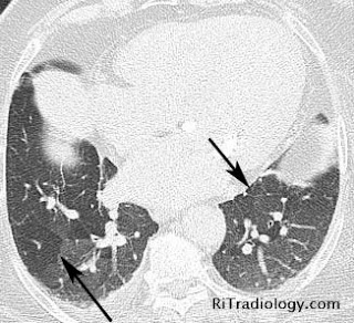 RiT radiology: August 2013