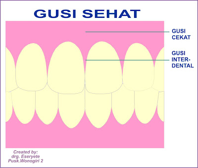 PDGI CABANG WONOGIRI: MENGENALI GIGI KITA