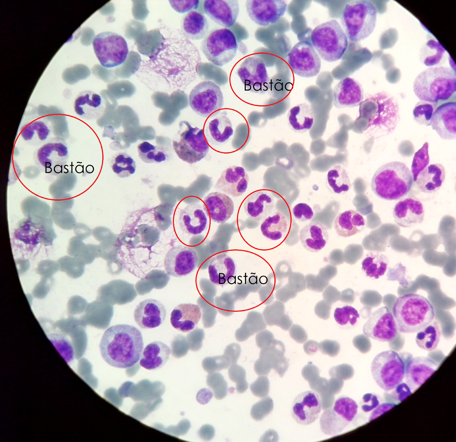 Hematologia Clínica : Atlas de Hematologia