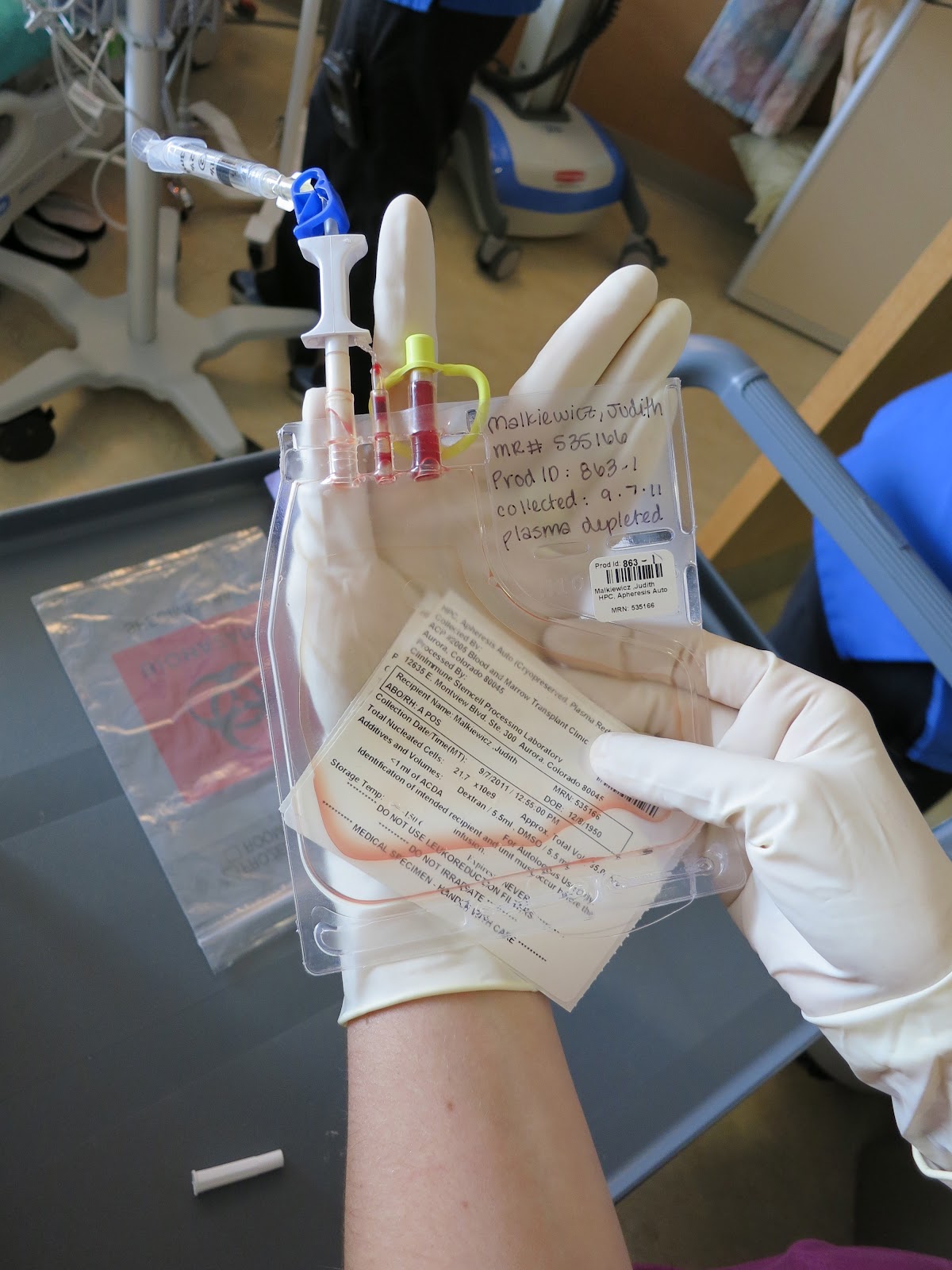 jm's Adventure with Multiple Myeloma: 2nd Autologous Stem Cell ...