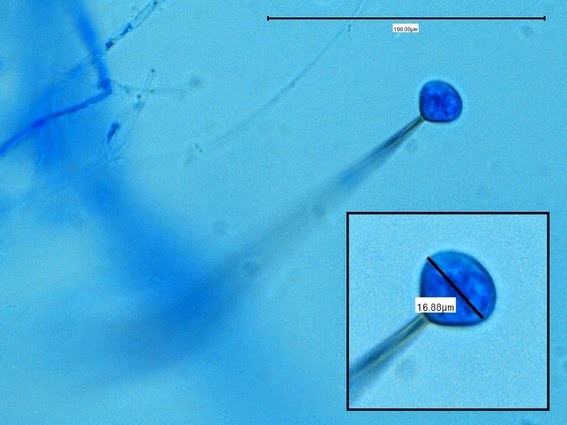 Fun With Microbiology (What's Buggin' You?): Apophysomyces elegans ...