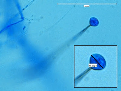 Fun With Microbiology (What's Buggin' You?): Apophysomyces elegans ...