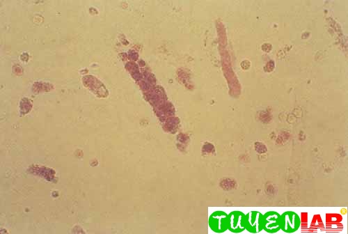 Atlas of Casts in urine | Free Medical Atlas