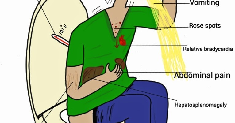 8 Homoeopathic Medicines to Treat Typhoid Fever