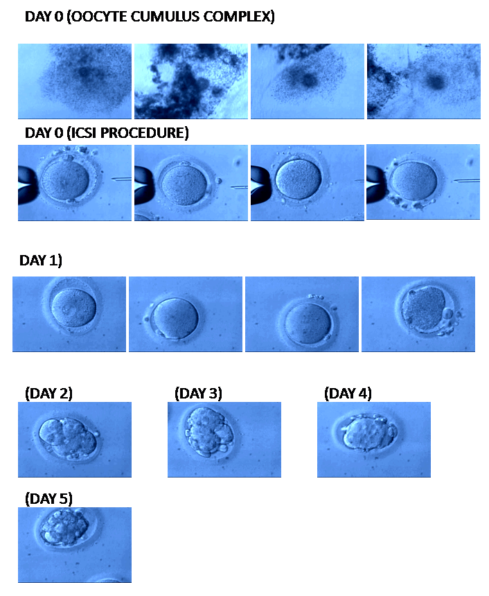 The story of an embryo
