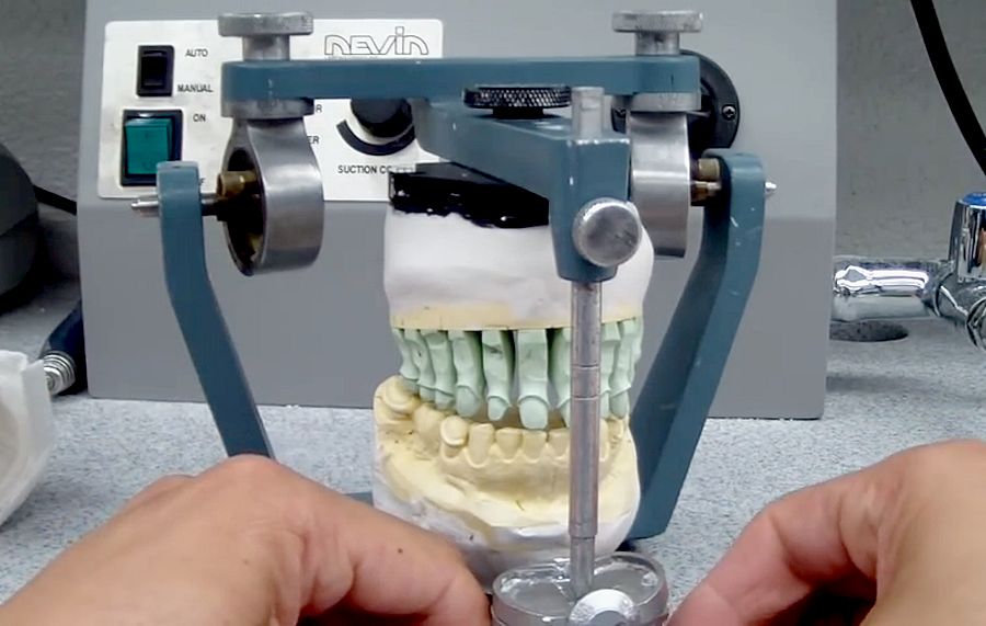 Occlusion Custom Incisal Guide Table What Is This Thing Video 1