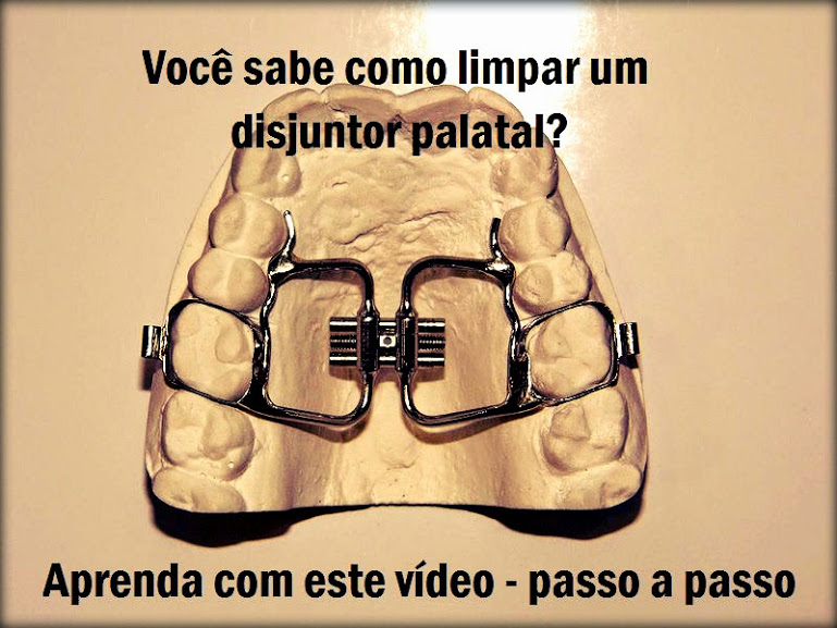 DISJUNTOR PALATINO: Você sabe como limpar um disjuntor palatal?