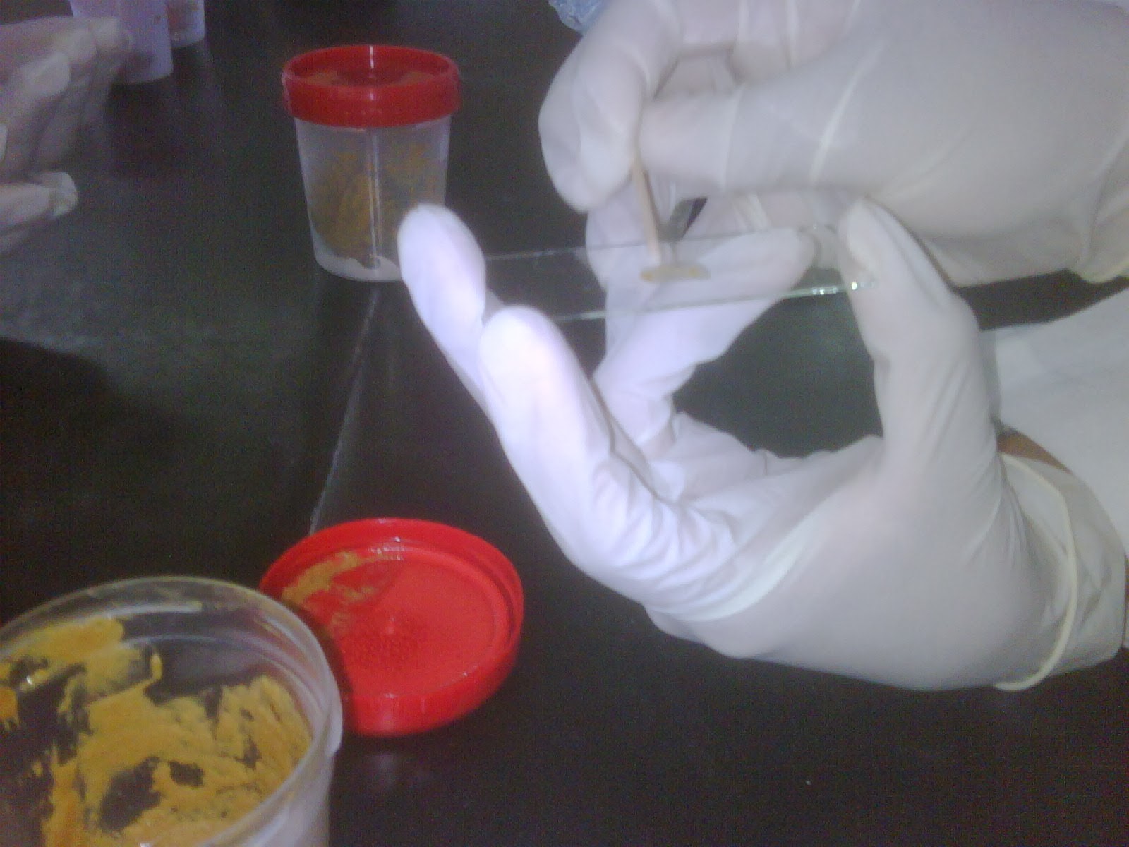 AMEBIASIS INTESTINAL: DIAGNOSTICO