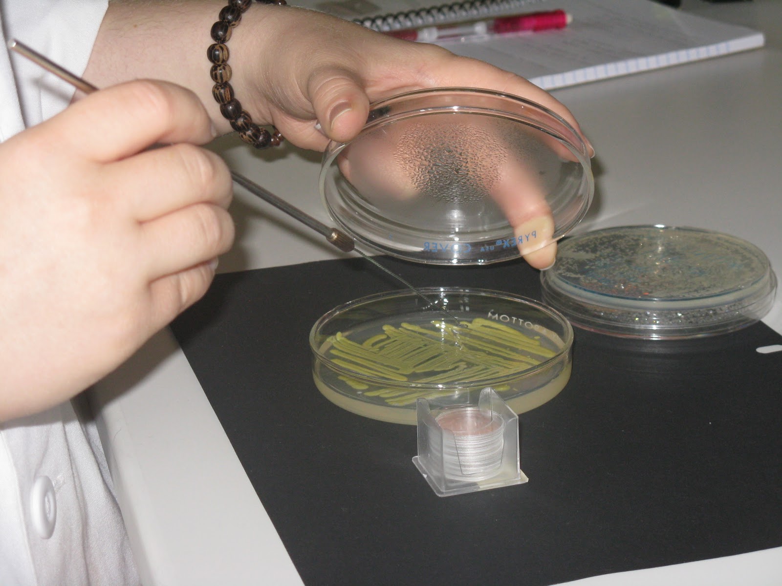 Samantha and Sarah's Microbiology Lab Journal: Staining Bacteria ...