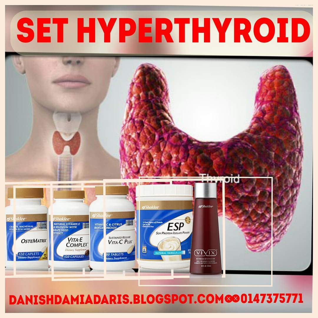 3D health beauty supplement: KENALI TIROID ; PUNCA, GEJALAN DAN CARA ...