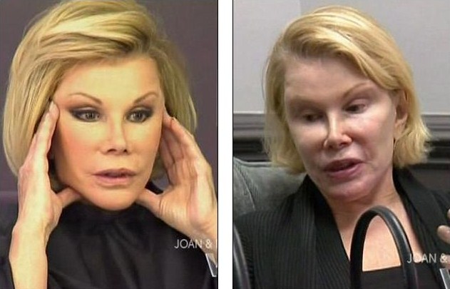 Free General Fashion: Joan Rivers 2012 Plastic Surgery: Without Makeup ...