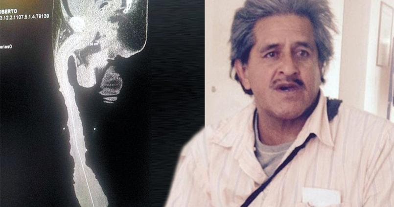 Latest Updates: I Can Never Penetrate Anyone Because Its Too Thick ...