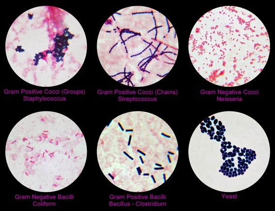Fun With Microbiology (What's Buggin' You?): Okay, Why so much Fungus???