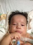 Living With Trisomy 13 New beginnings of HOPE: Brilen